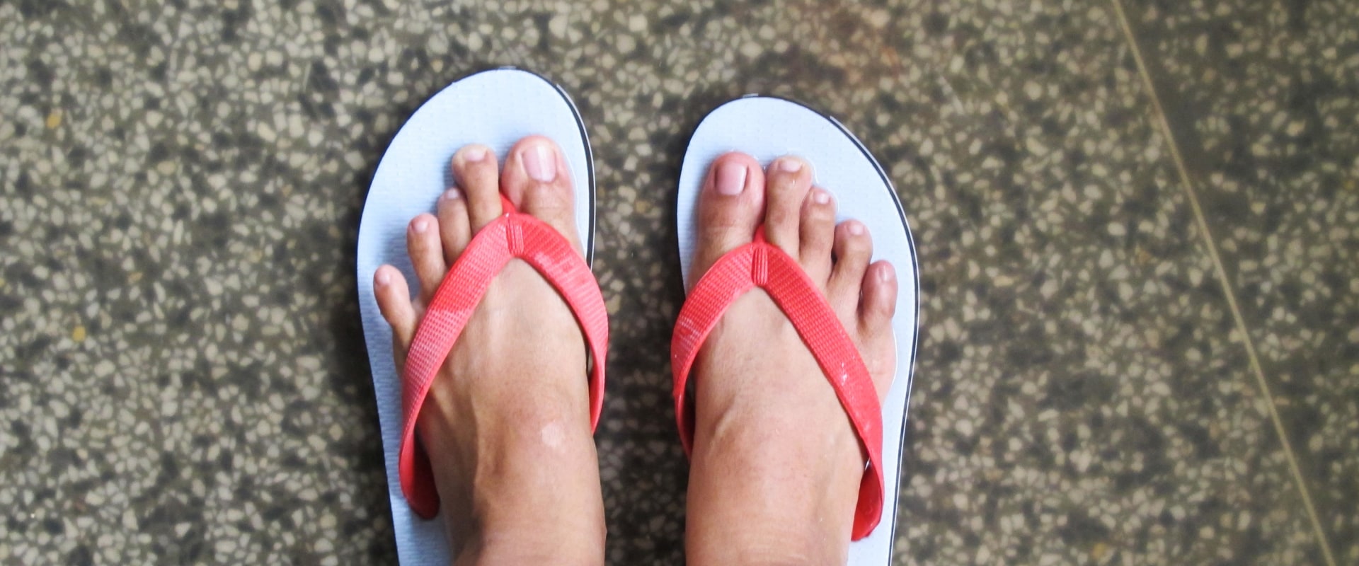 Does wearing open toed shoes help against toenail fungus?